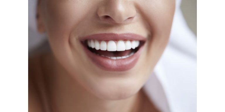 Achieve A Symmetrical Smile With Gum Contouring | Dr. Alex Midtown NYC ...