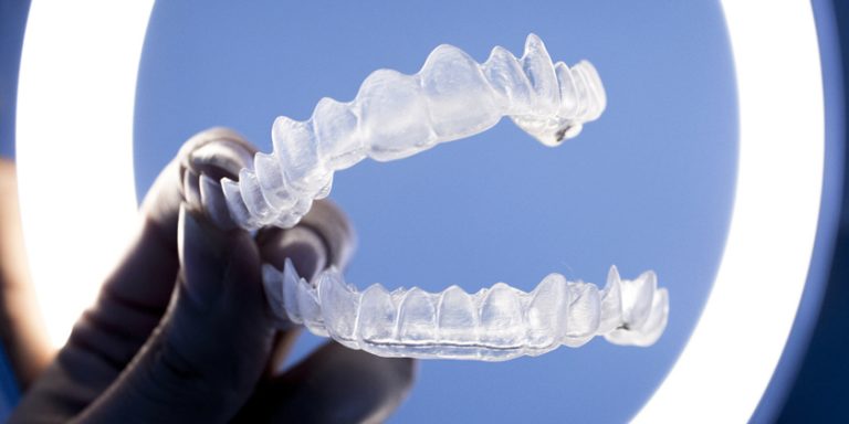 Easy Invisalign Alignment Tray Maintenance Tips | Dr. Alex Midtown NYC ...
