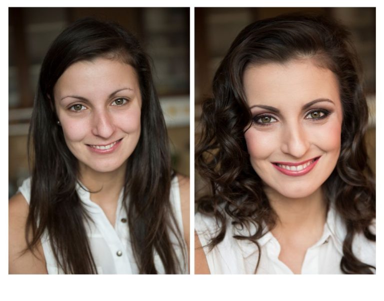 Where To Find The Best Smile Makeover In New York City | Dr. Alex ...